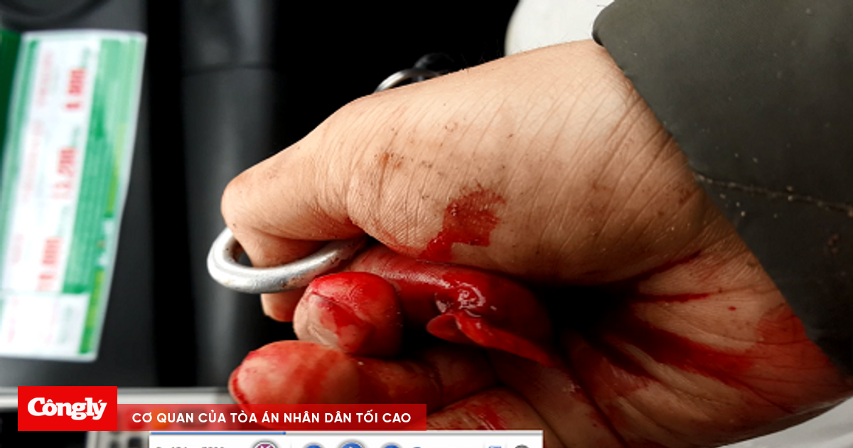 Hé lộ manh mối 3 thanh niên đánh nhà báo Đỗ Doãn Hoàng